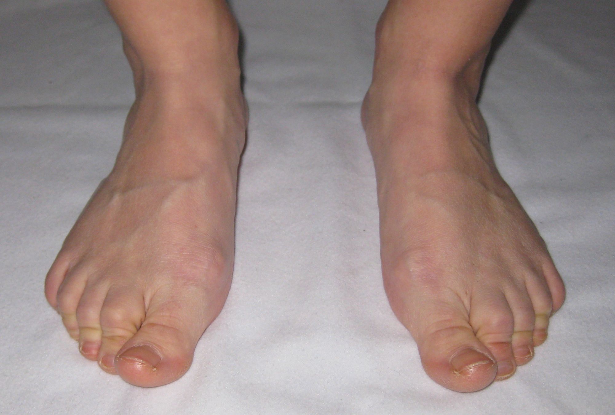 Jaká je funkce palce na noze?